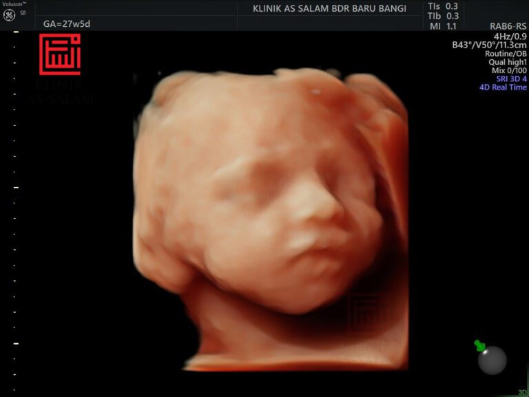 Tips Nak dapat Gambar 3D4D Yang Cantik? 🤰🏼 - Klinik As-Salam