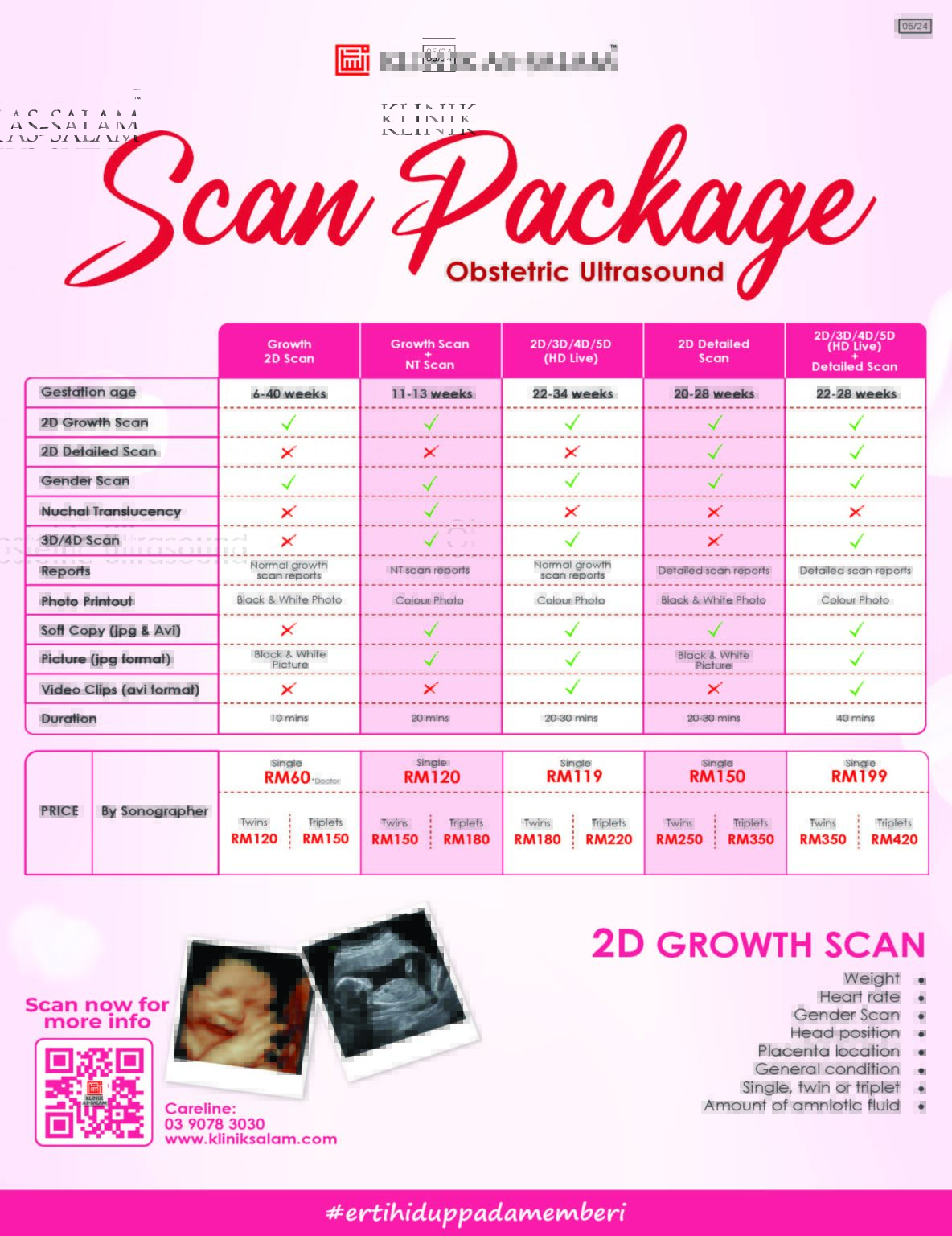 Clinic Ultrasound Scan Baby 2D/3D/4D/5D/6D